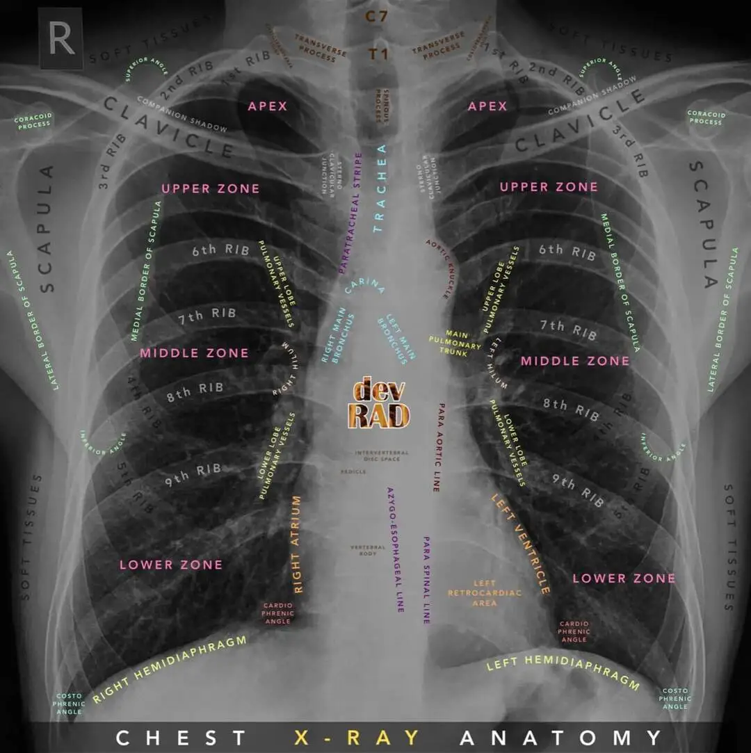 Radiology Vibes | Online Learning Platform For Radiologists.