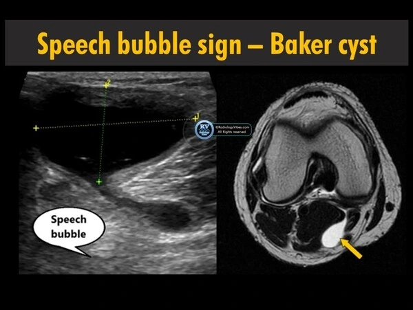 Radiology Vibes | Online Learning Platform For Radiologists.