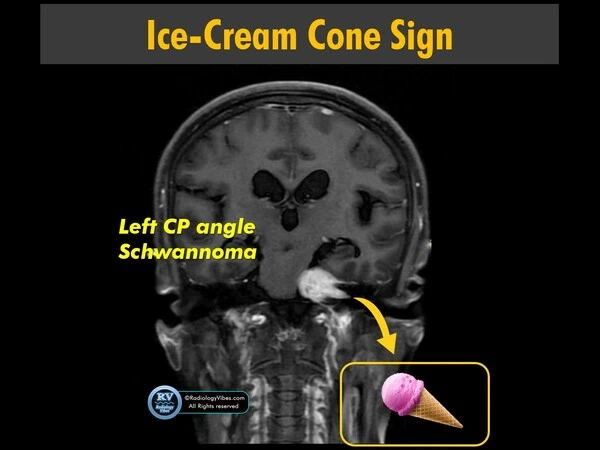 Radiology Vibes | Online Learning Platform For Radiologists.