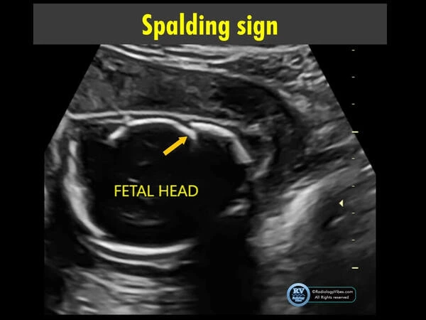 Radiology Vibes | Online Learning Platform For Radiologists.