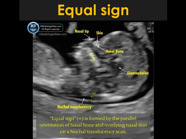 Radiology Vibes | Online Learning Platform For Radiologists.