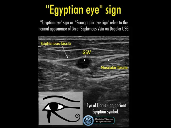 Radiology Vibes | Online Learning Platform For Radiologists.