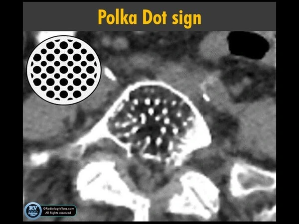 Radiology Vibes | Online Learning Platform For Radiologists.