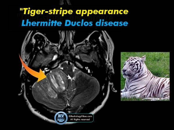 Radiology Vibes | Online Learning Platform For Radiologists.