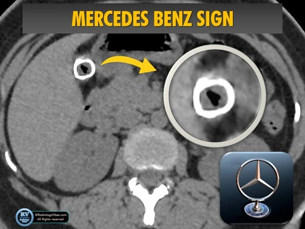 Radiology Vibes | Online Learning Platform For Radiologists.