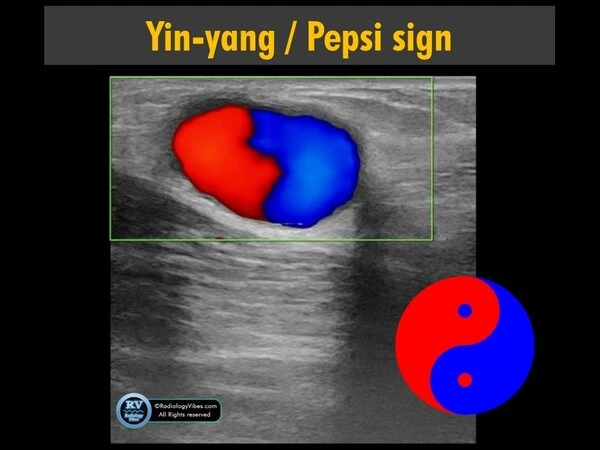 Radiology Vibes | Online Learning Platform For Radiologists.