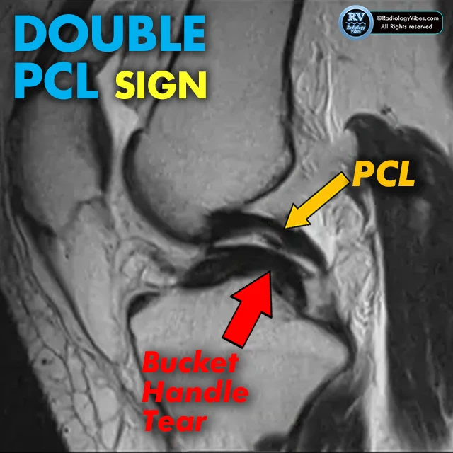 Radiology Vibes | Online Learning Platform For Radiologists.