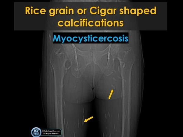 Radiology Vibes | Online Learning Platform For Radiologists.