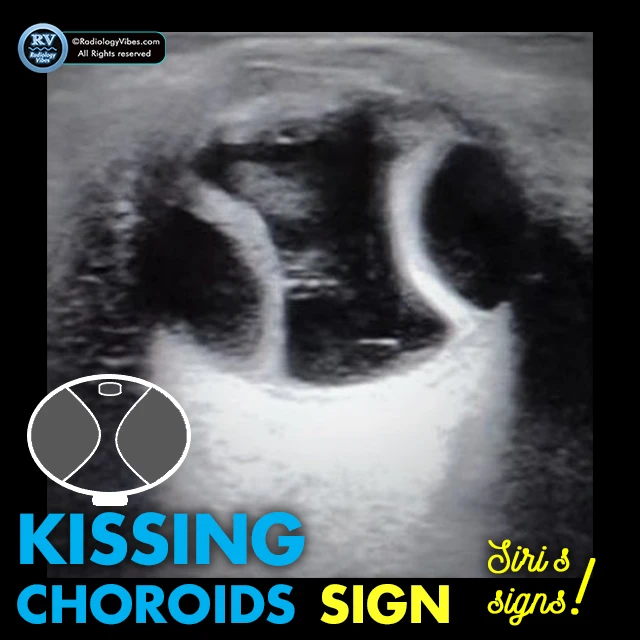 Radiology Vibes | Online Learning Platform For Radiologists.